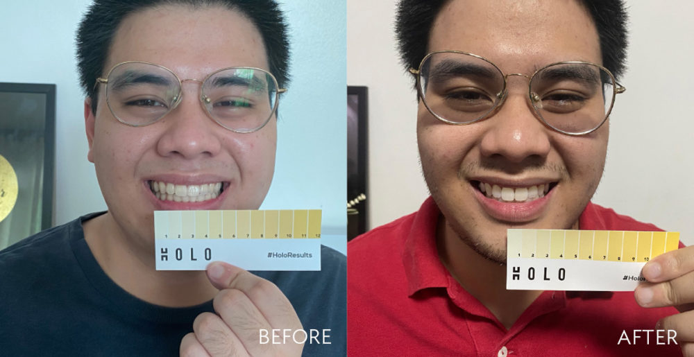 Holo Teeth Whitening at Home | Philippines Wedding Blog